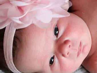 Tubal Ligation - Pomeroy Technique