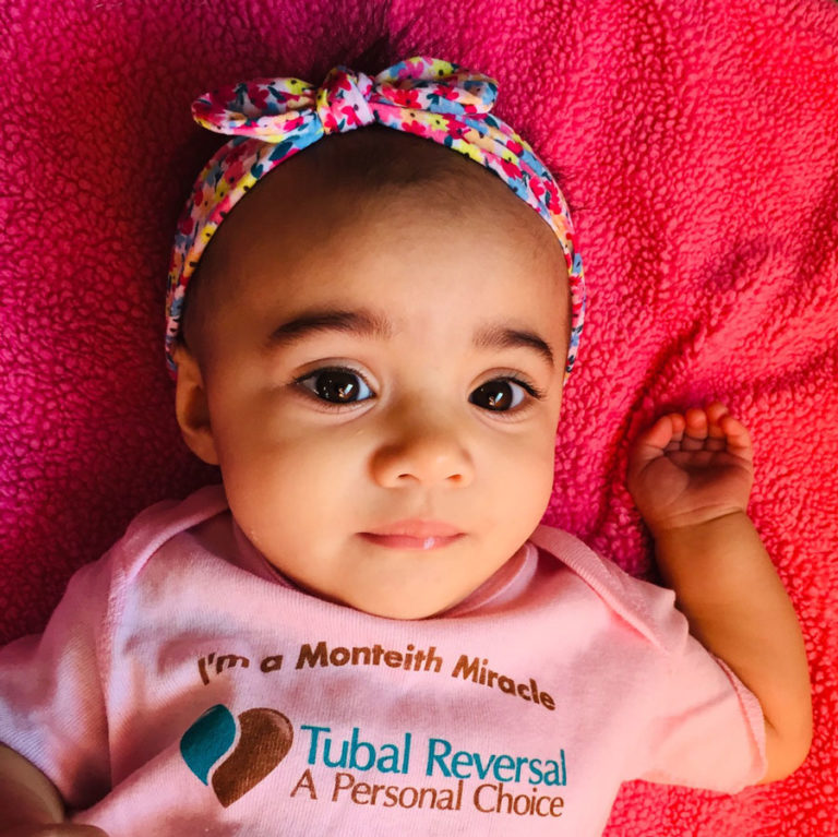 Best Procedure To Reverse Adiana Tubal Ligation