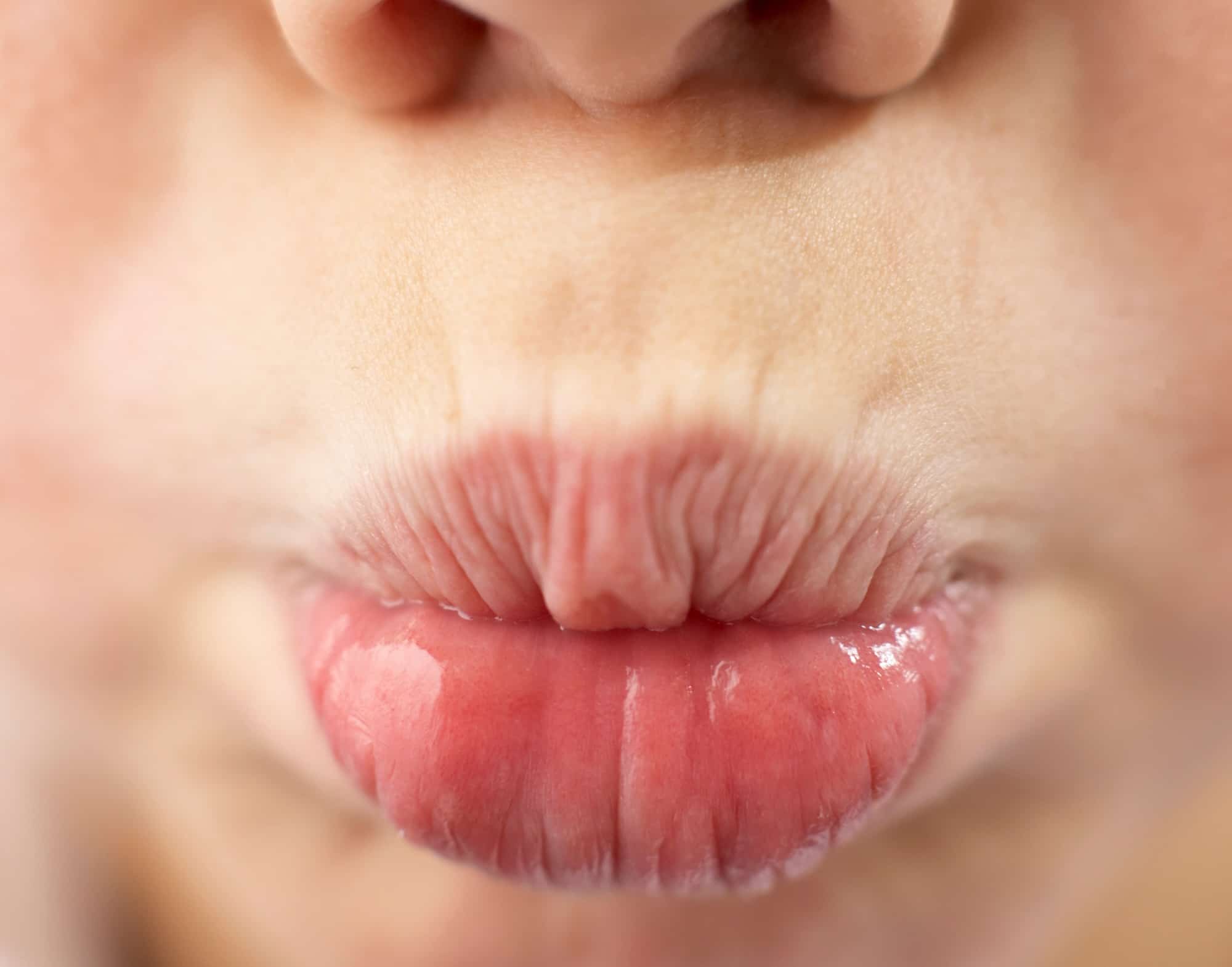 How Can You Tell If Your Tubes Are Open After Tubal Reversal Surgery?